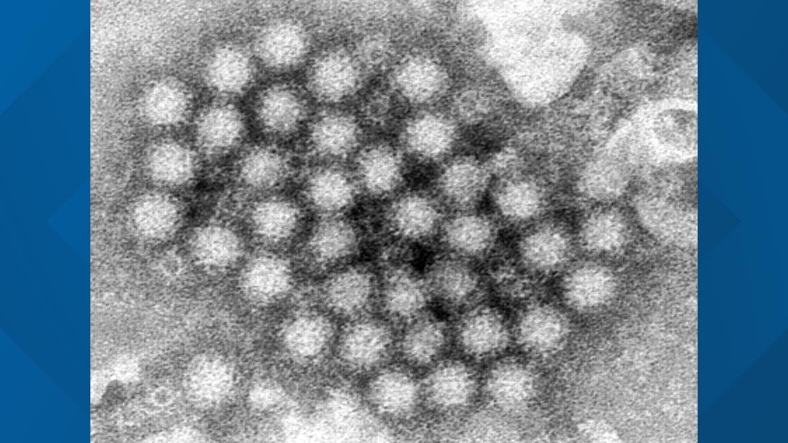 CDC: Norovirus outbreaks, infections surge in US | cbs19.tv