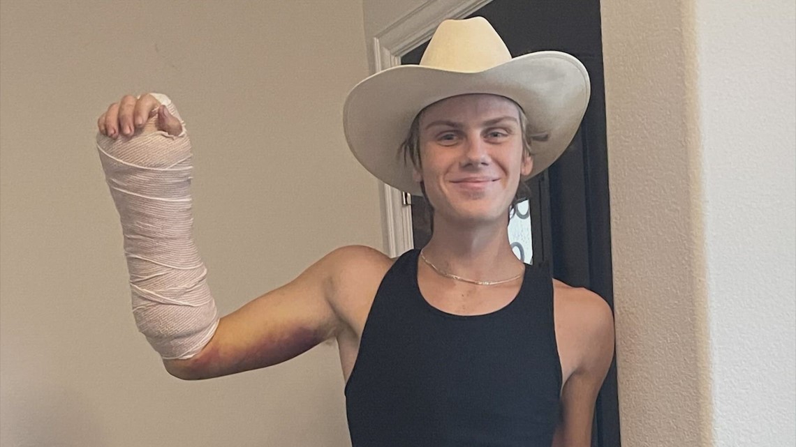 Defective firework causes permanent damage to Houston teen | cbs19.tv