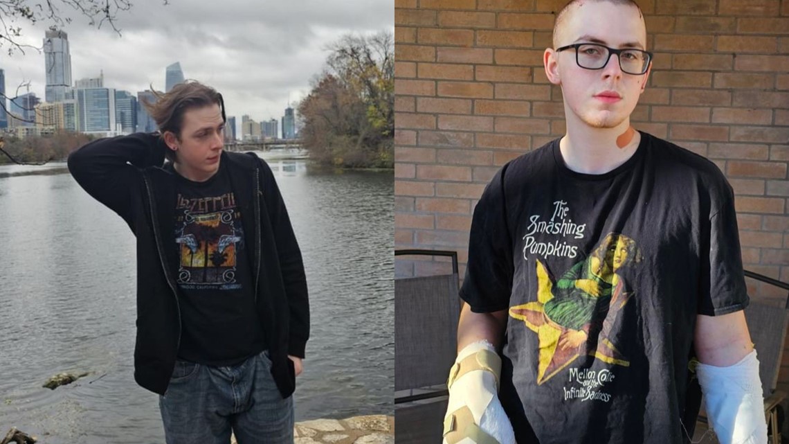 Austin machete attack survivor Seth Gott gives update on recovery ...