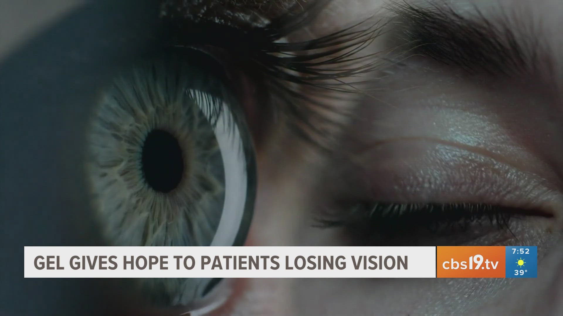 Gel gives hope to patients losing vision | cbs19.tv