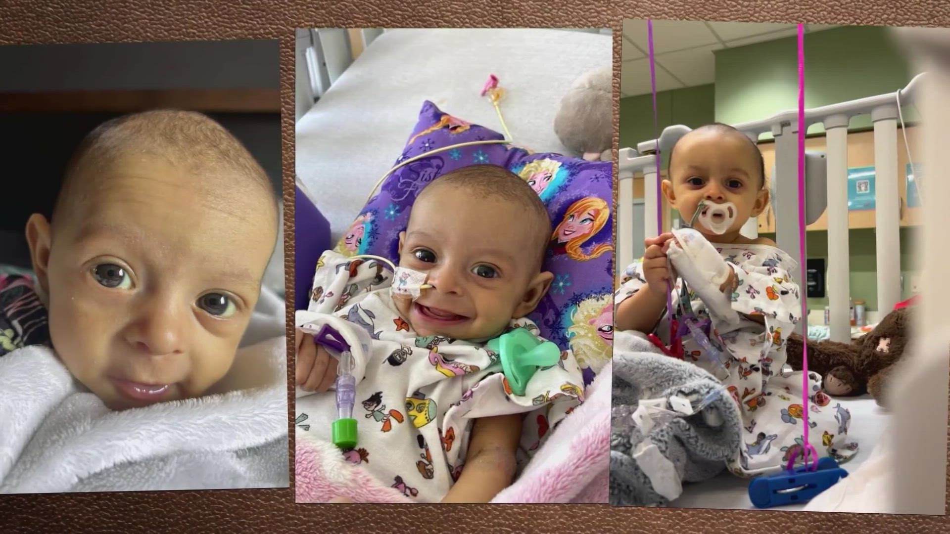 Rare surgery uses one liver to save two lives | cbs19.tv