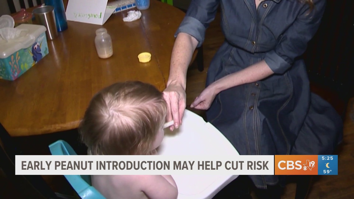Early peanut introduction may help cut allergy risk | cbs19.tv