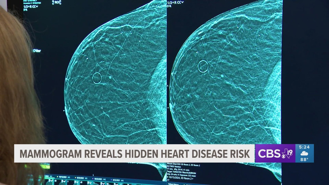 HEALTH: Mammogram reveals hidden heart disease risk | cbs19.tv