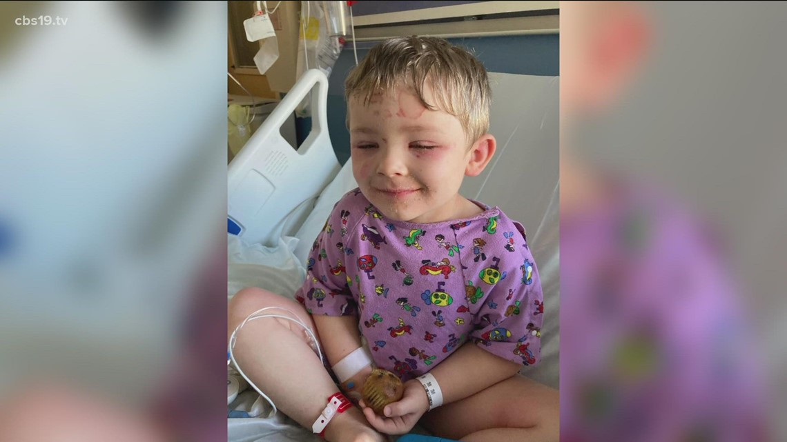 4-year-old boy battles rare skin disorder after getting cut | cbs19.tv