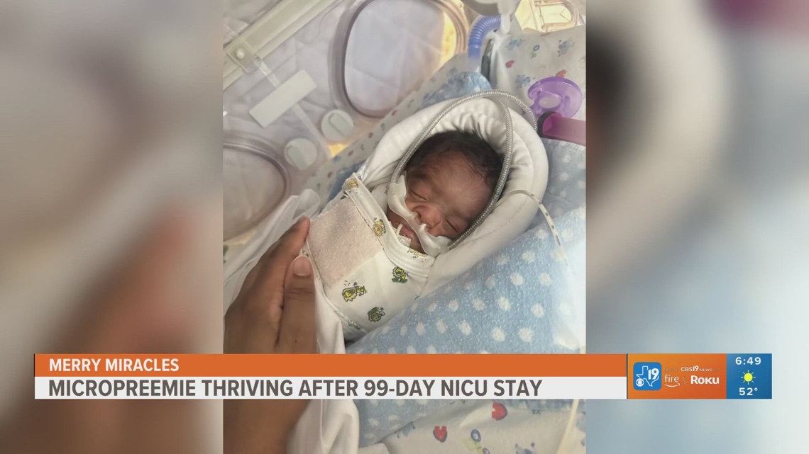 MERRY MIRACLES: Micro-preemie thrives after 99 days in NICU thanks to ...