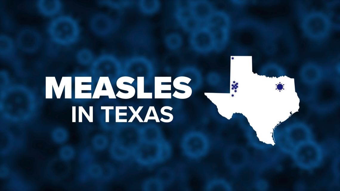 Measles patient treated at East Texas hospital | cbs19.tv