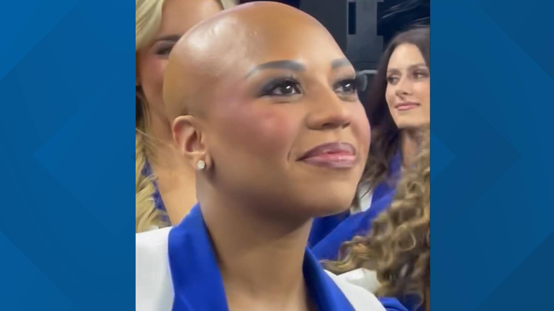 Cowboys cheerleader cheers without wig for alopecia awareness | cbs19.tv